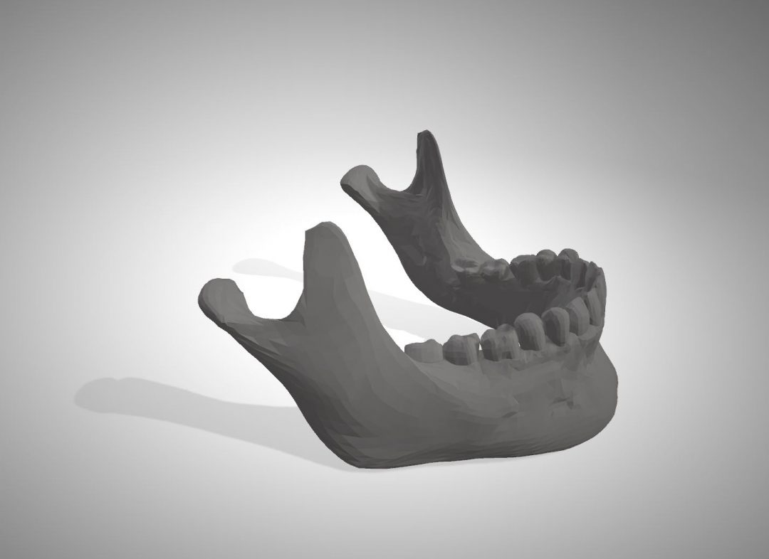 Mandible Demo – Dentistry Downloaded