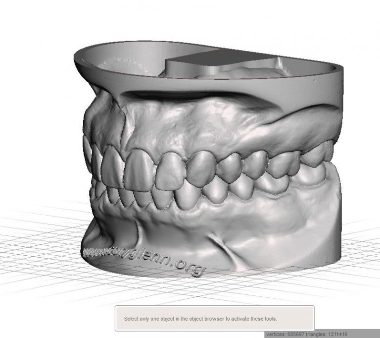 Printable Typodont – Dentistry Downloaded